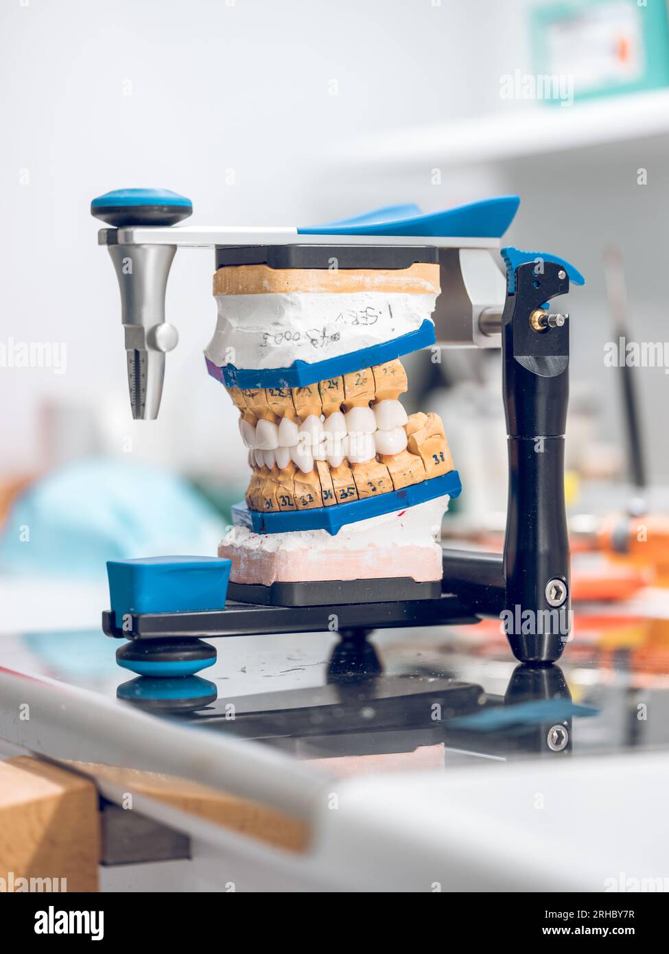 From above of set of metal ceramic implants of jaw denture installed ...