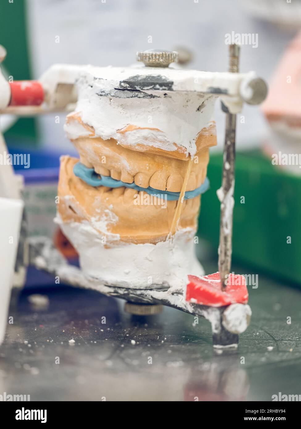 Denture of plastic material placed in articulator for solidifying while ...