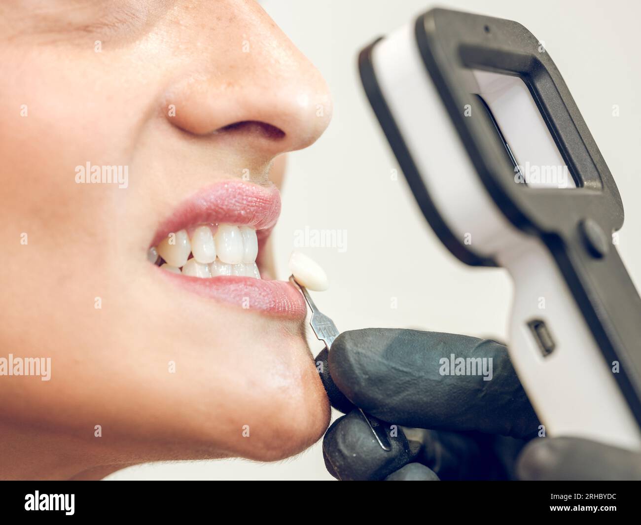 Side view of faceless unrecognizable stomatologist with loupe and ...