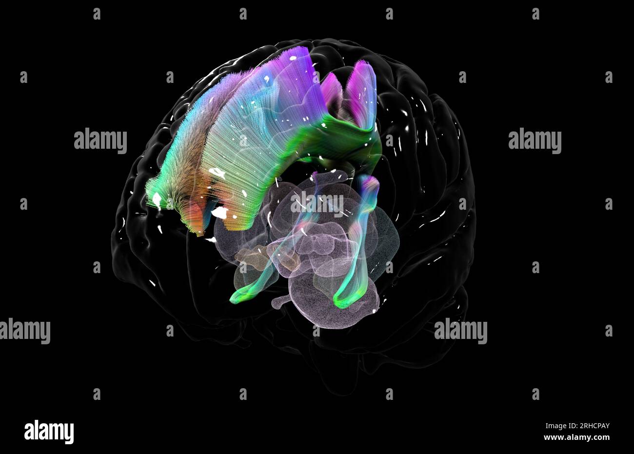 Cingulum bundle, DTI MRI scan Stock Photo - Alamy