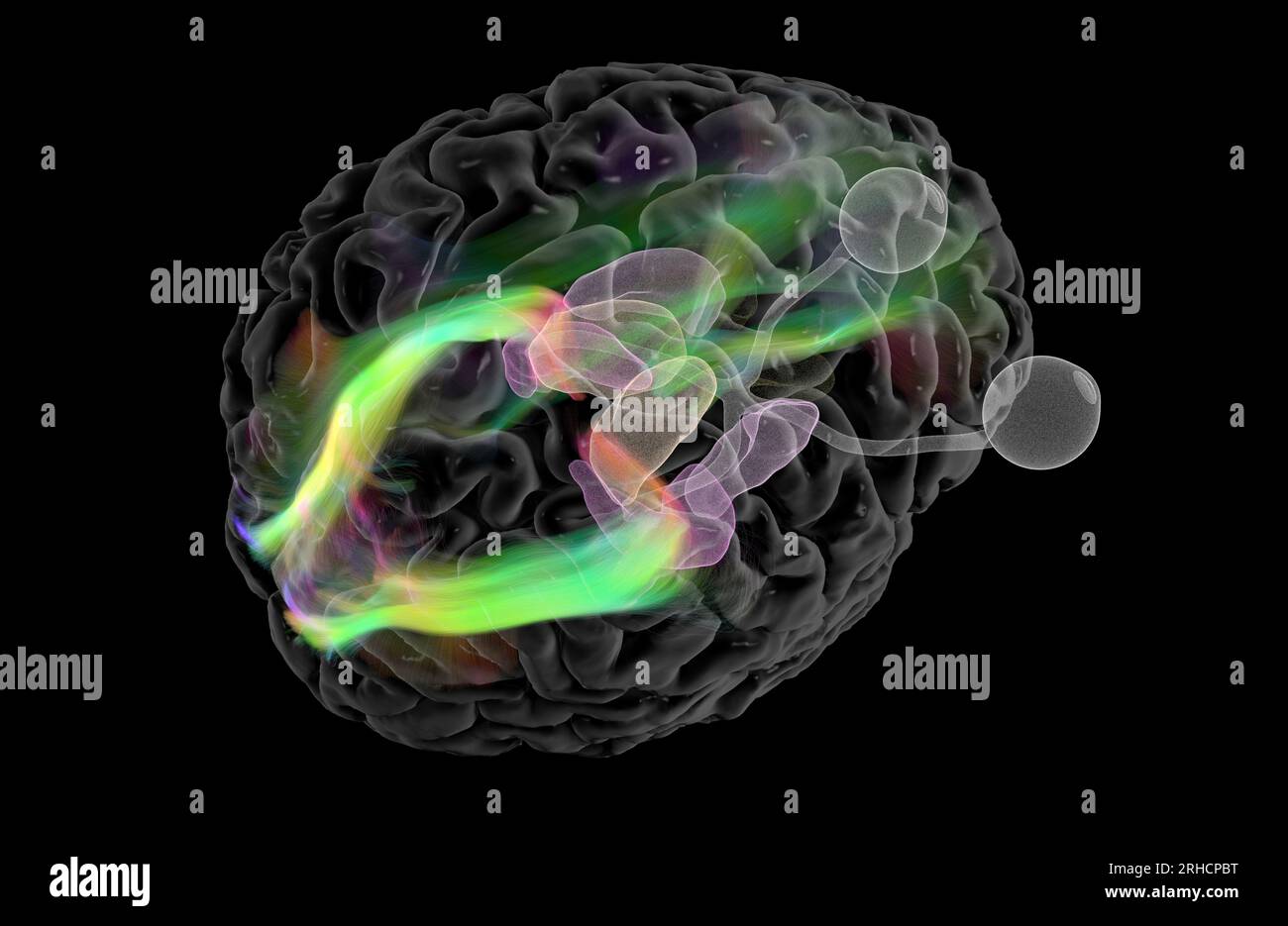 Brain's visual pathways, DTI MRI scan Stock Photo - Alamy