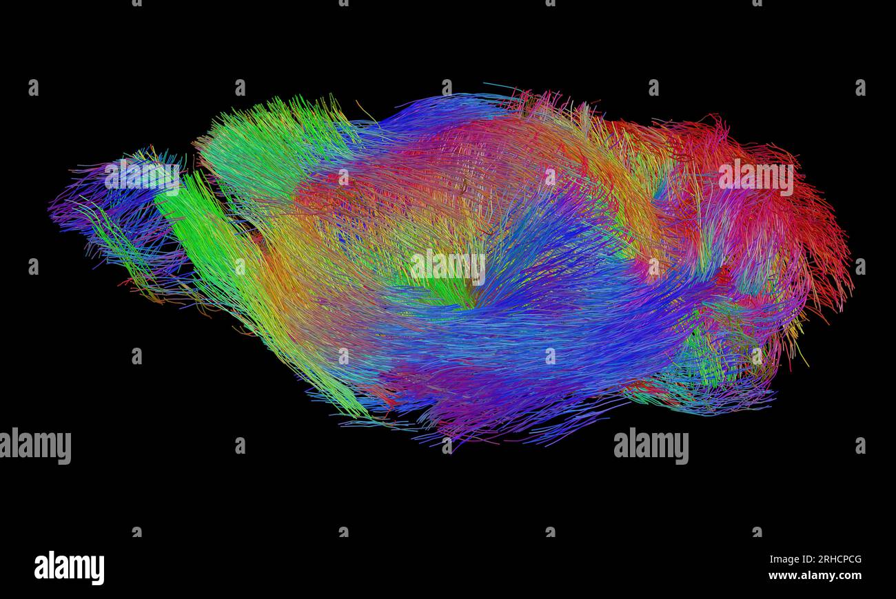Mouse white matter fibres, DTI MRI scan Stock Photo - Alamy