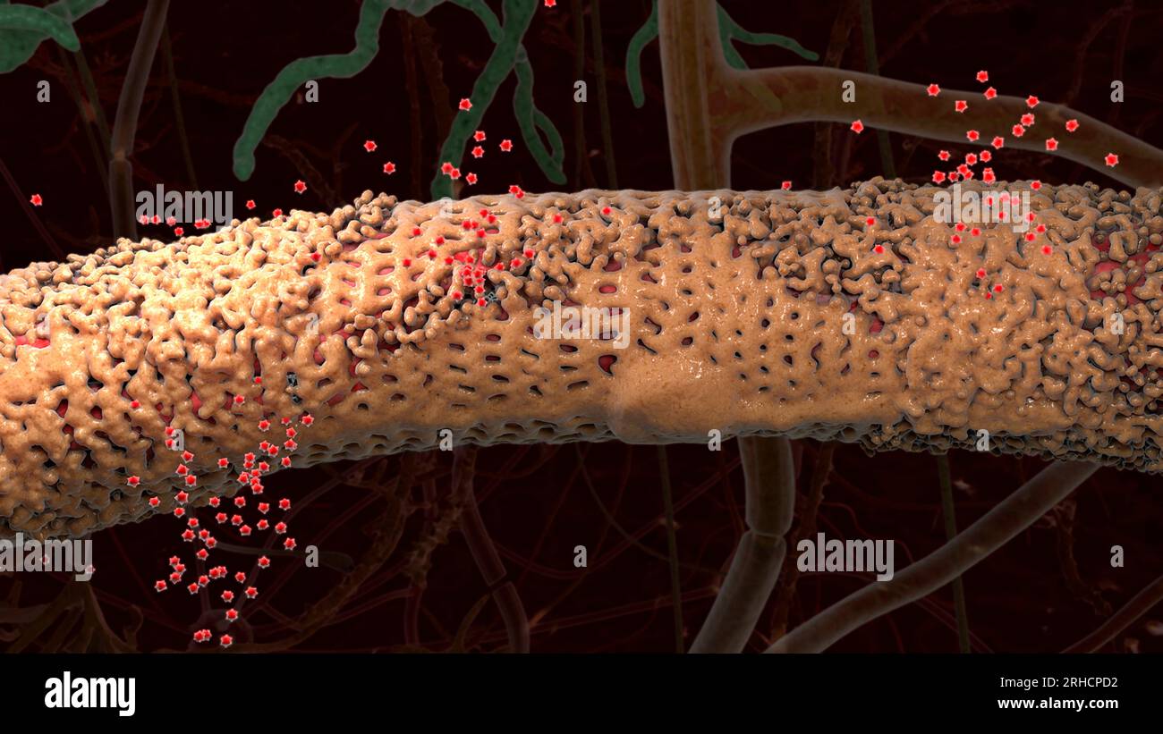 Damaged brain capillary, illustration Stock Photo - Alamy