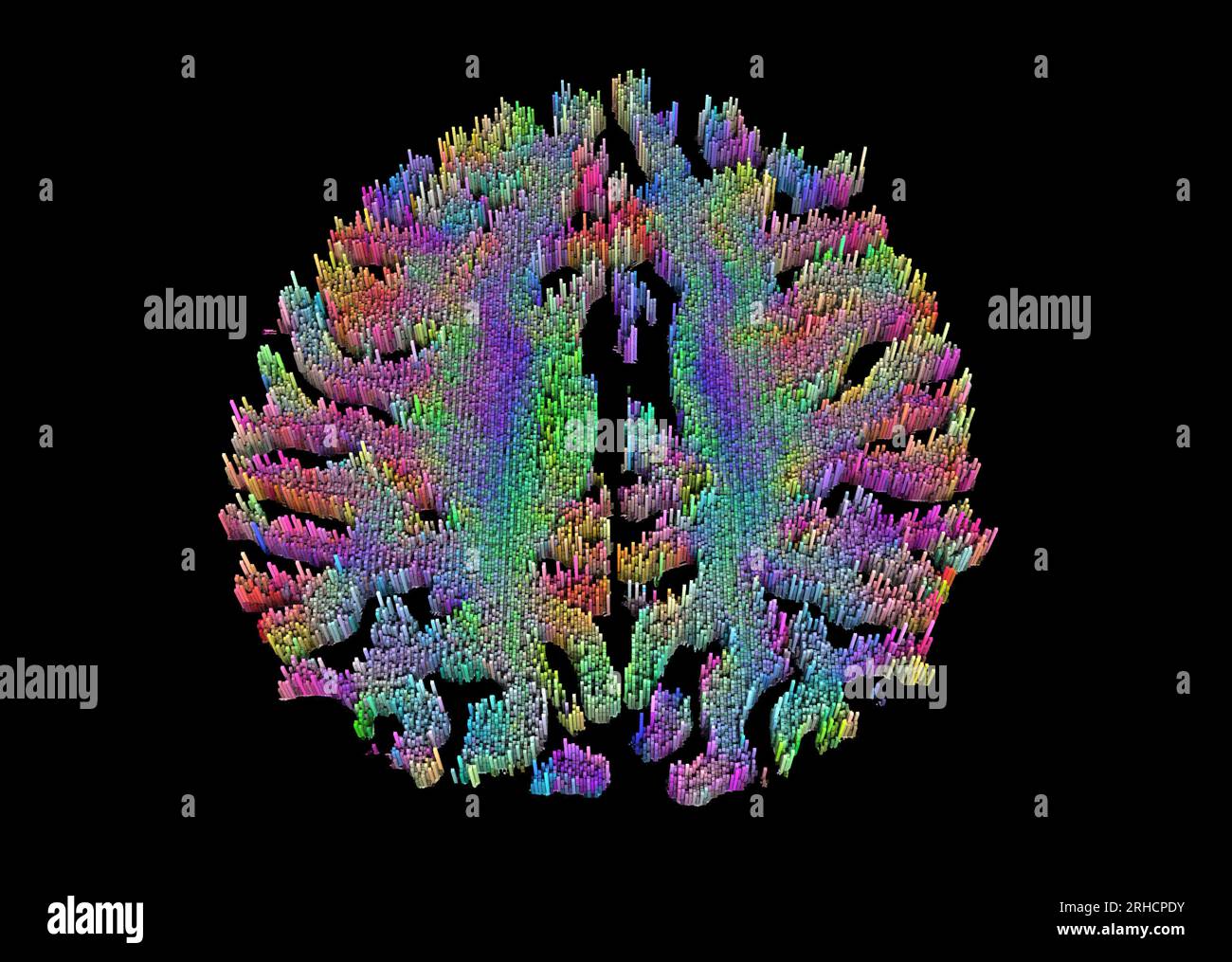 White matter fibres, DTI MRI scan Stock Photo - Alamy White matter fibres, DTI MRI scan Stock Photo - Alamy