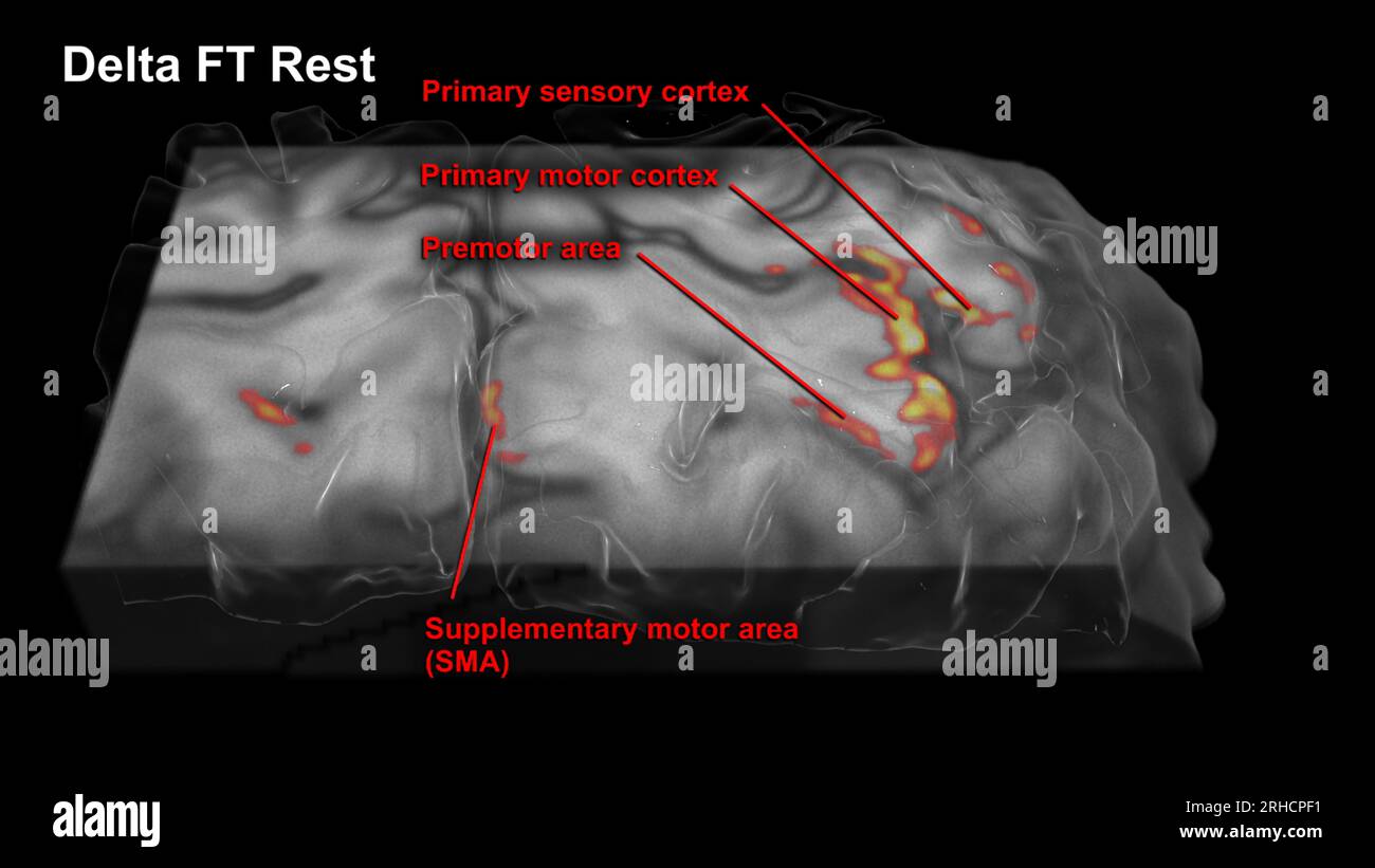 Resting brain, fMRI scan Stock Photo - Alamy