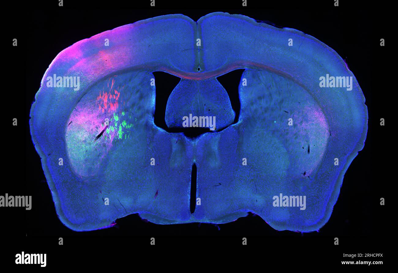 Mouse brain, fluorescent micrograph Stock Photo - Alamy