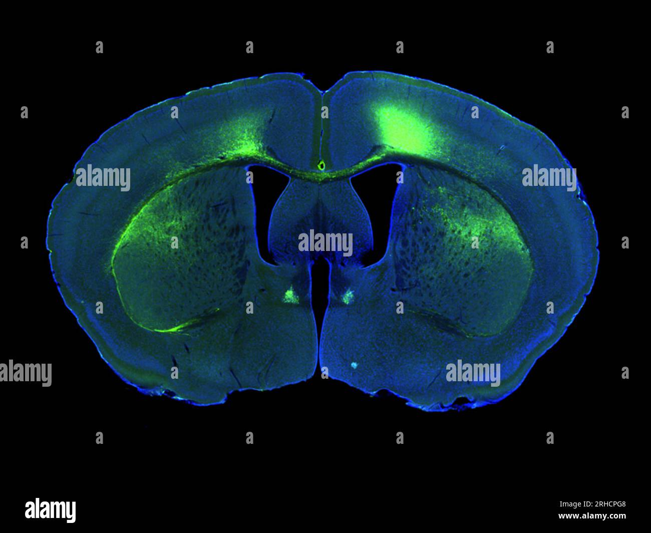 Mouse brain, fluorescent micrograph Stock Photo - Alamy