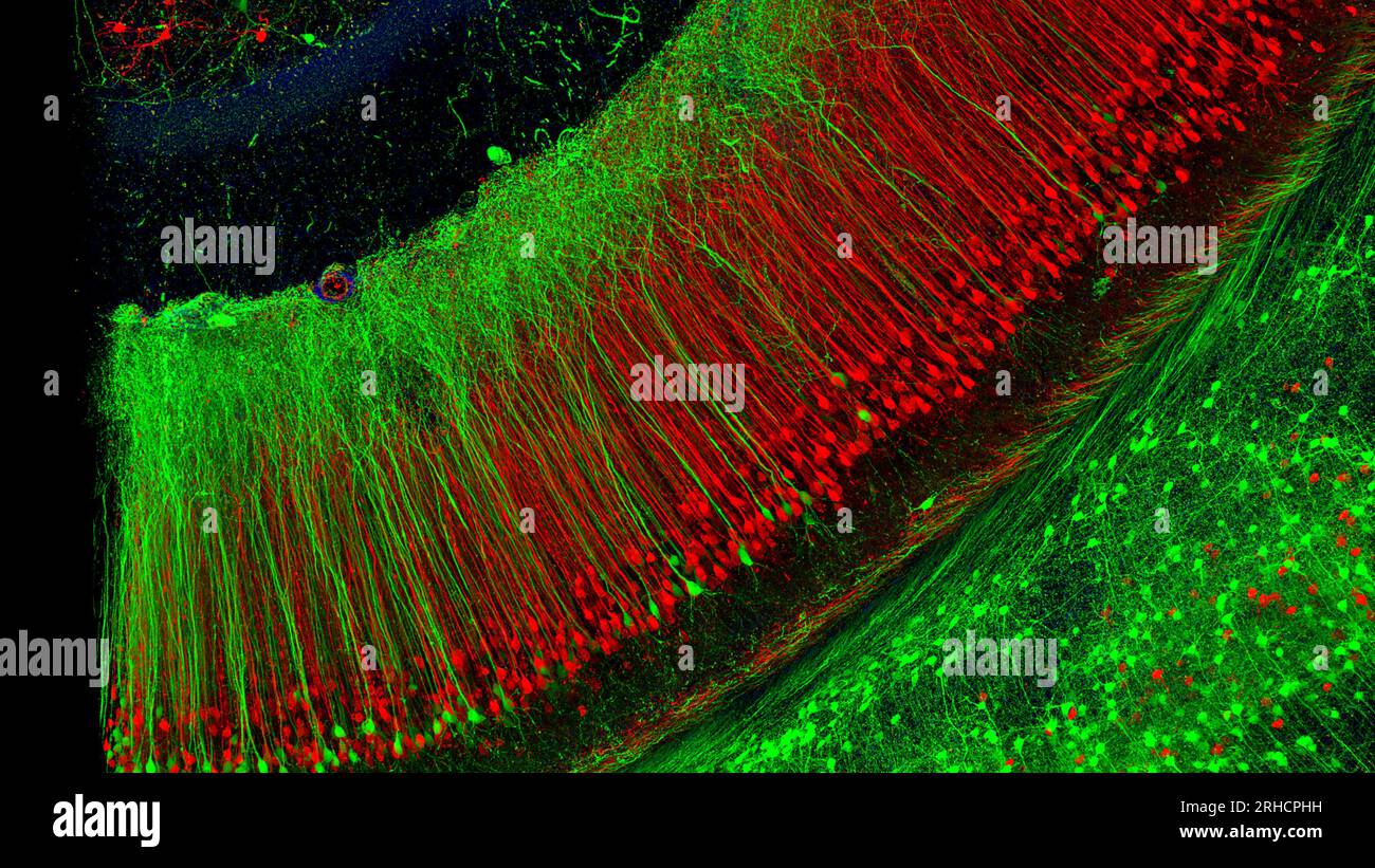 Mouse neuronal fibres, fluorescent micrograph Stock Photo - Alamy