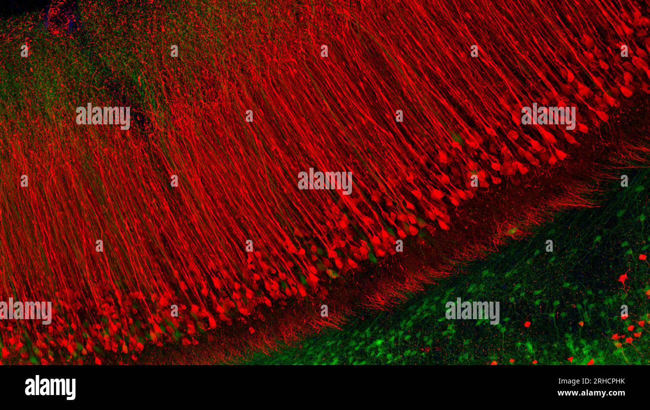 Mouse neuronal fibres, fluorescent micrograph Stock Photo - Alamy