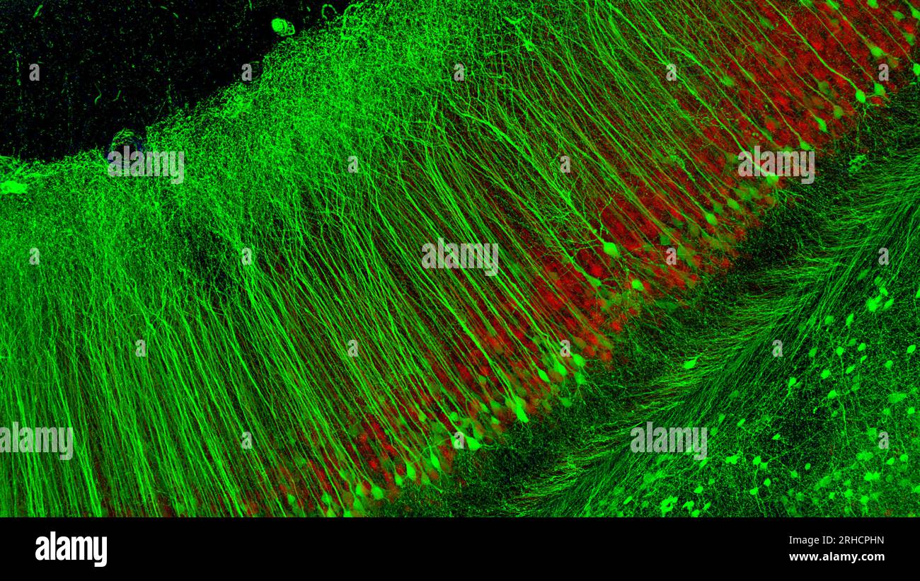 Mouse neuronal fibres, fluorescent micrograph Stock Photo - Alamy
