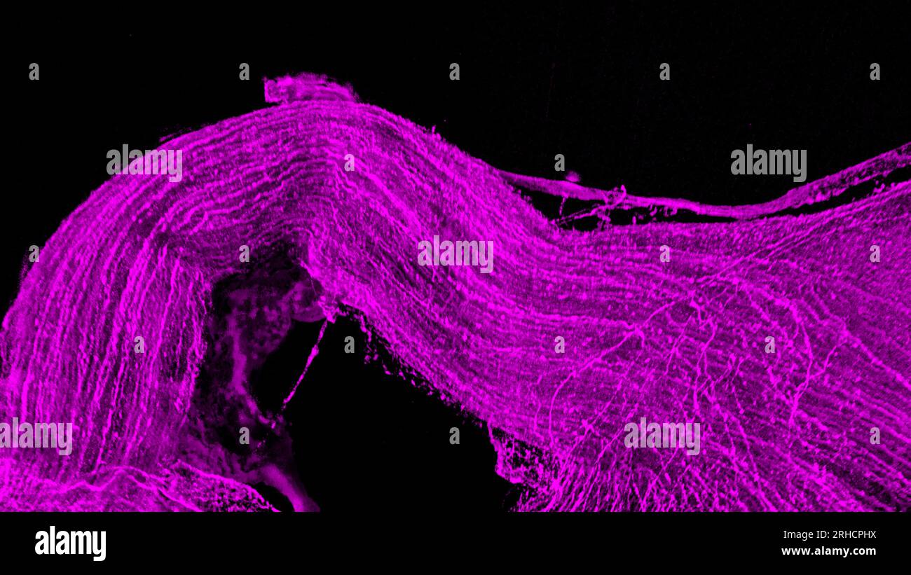 Rat optic nerve, light micrograph Stock Photo - Alamy