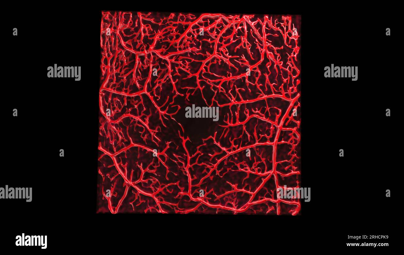Retinal blood vessels, OCT angiography scan Stock Photo - Alamy