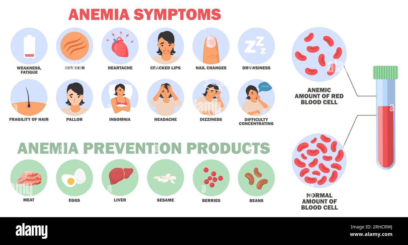 Anemia symptoms and prevention products info graphic Stock Vector Image ...