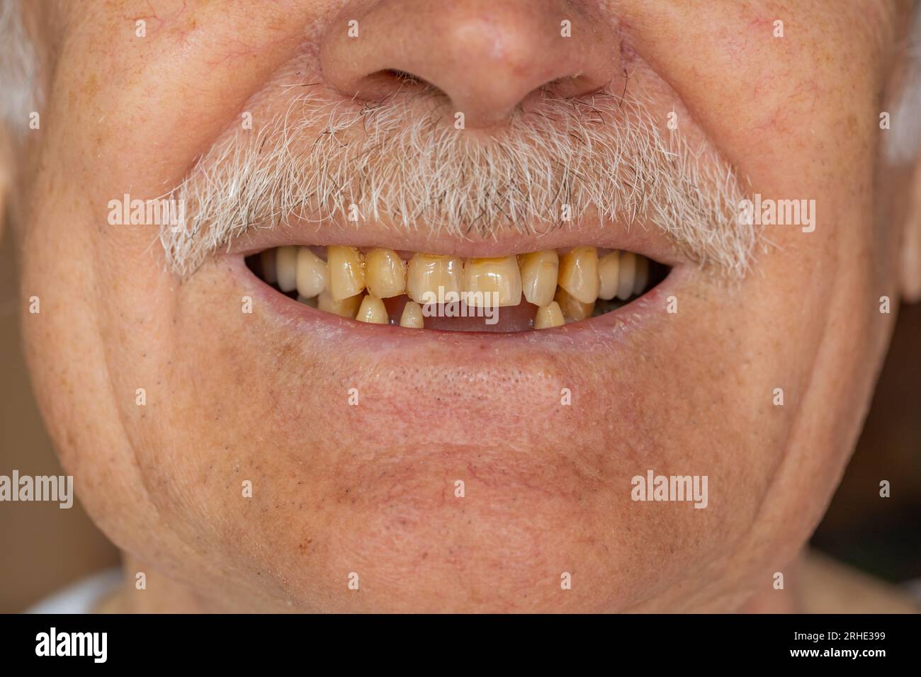 Close-up macro shot of toothless male smile mouth of senior elderly man ...