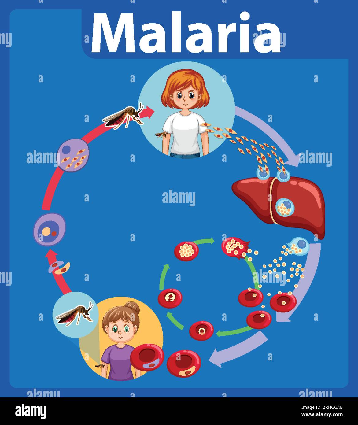 Illustrated infographic depicting the stages of malaria parasite ...