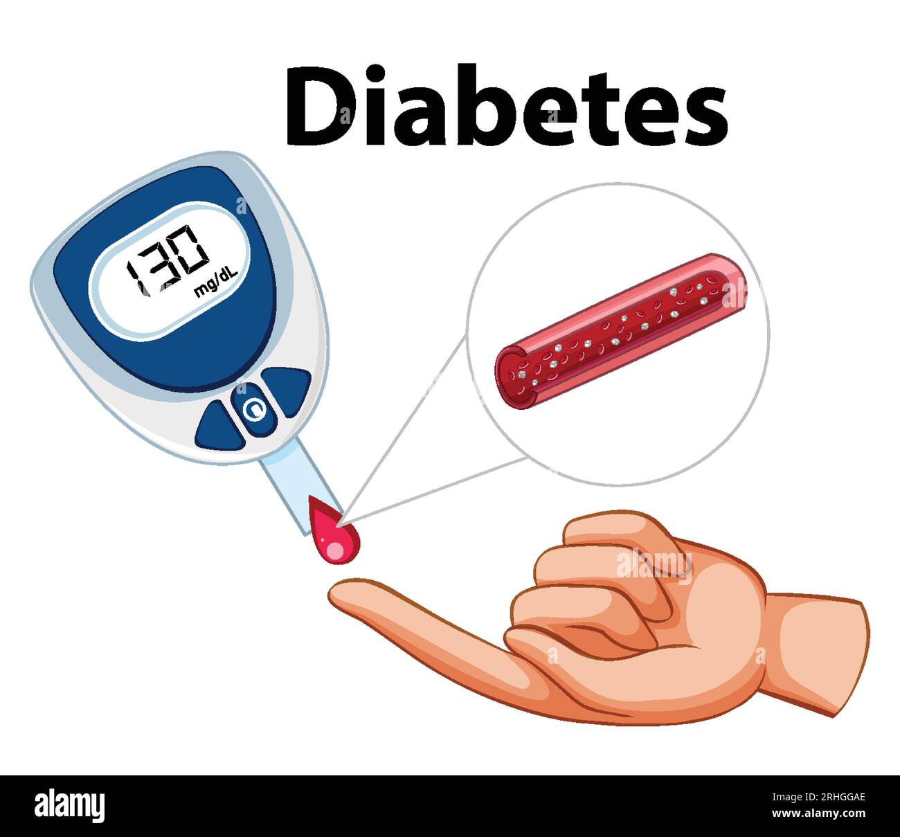 A Cartoon Style Illustration Of A Glucose Meter Device Used To Check