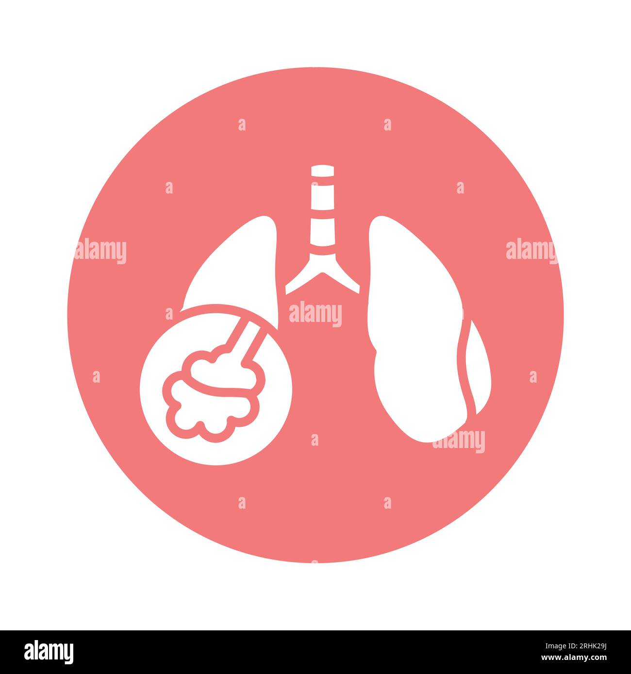 Pneumonia lung drawing hi-res stock photography and images - Alamy
