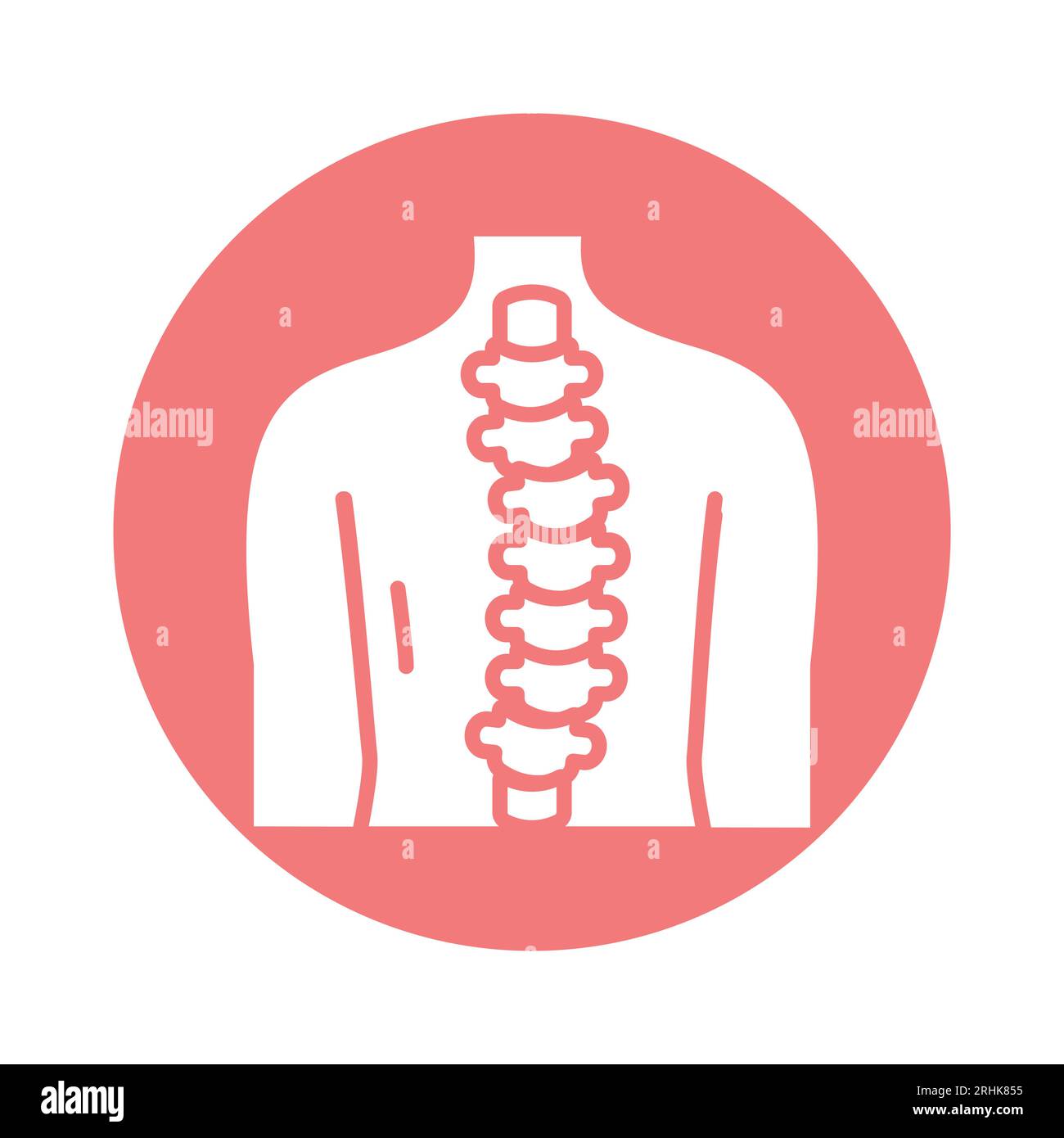 Scoliosis vector vectors hi-res stock photography and images - Alamy
