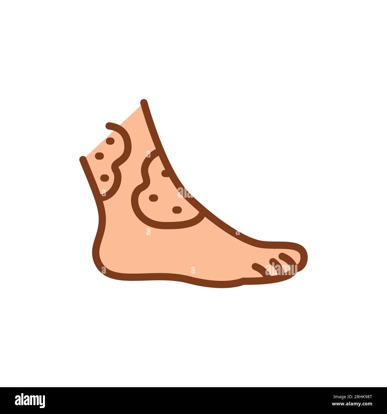 Atopic dermatitis black line icon. Dermatology disease. Skin problem ...