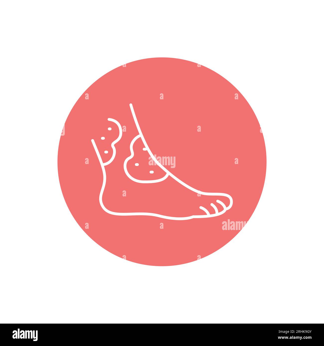 Atopic dermatitis vector vectors hi-res stock photography and images ...