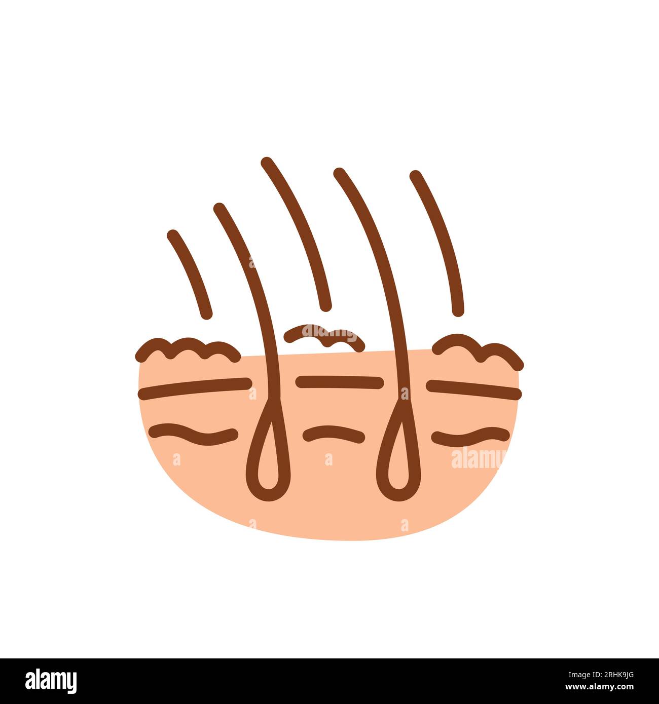 Dermatitis vector vectors hi-res stock photography and images - Alamy