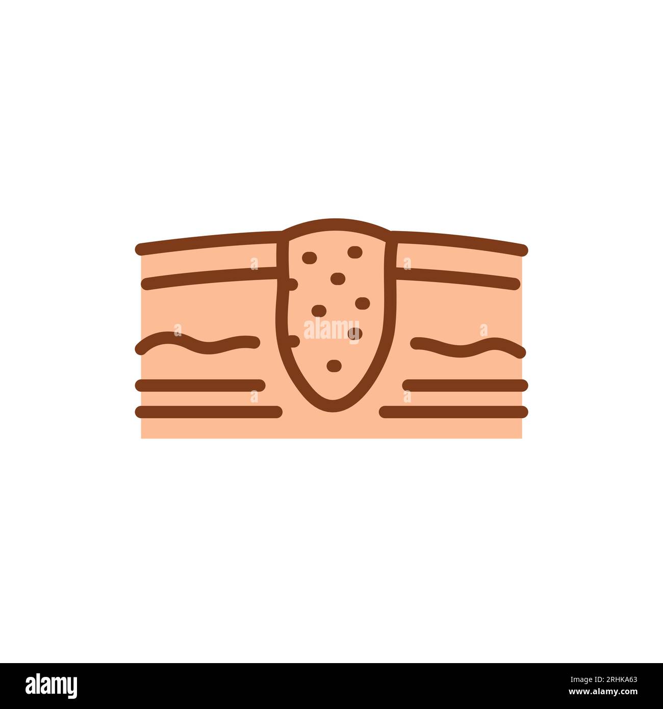 Skin Cancer Black Line Icon Dermatology Disease Skin Problem Stock