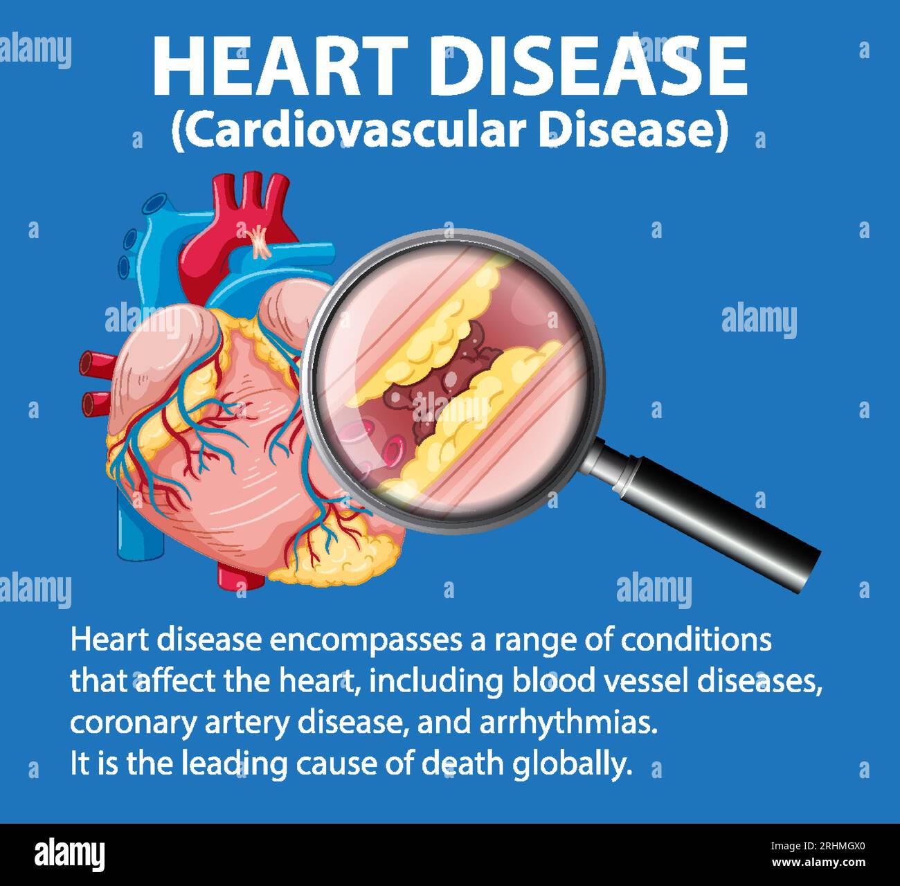 Illustrated infographic depicting sickness and heart disease in medical ...