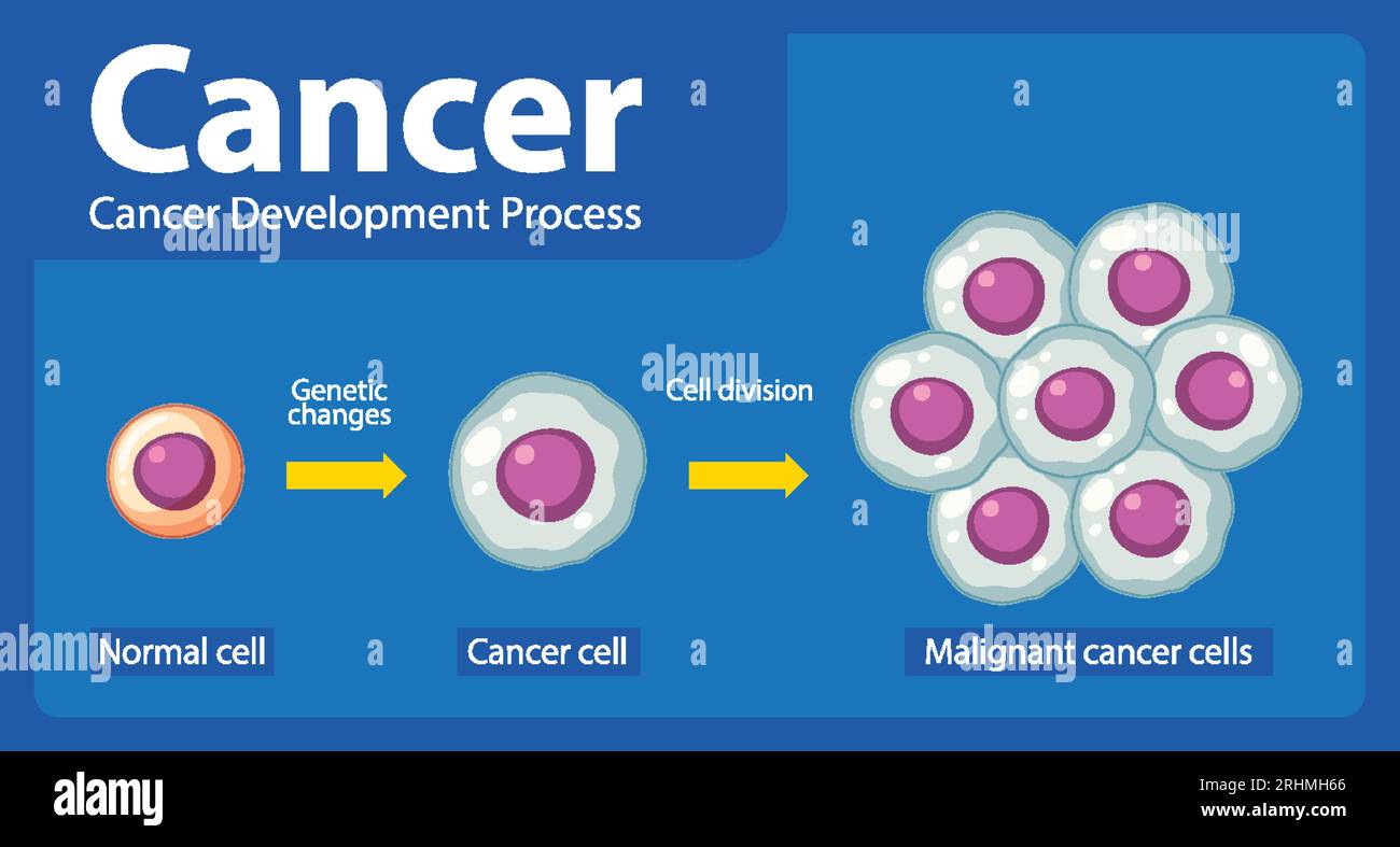 Understanding the development and processing of cancer cells through an ...