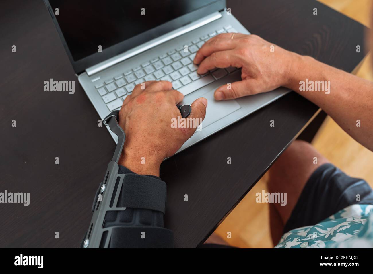Man with adjustable articulated elbow orthosis typing on laptop ...