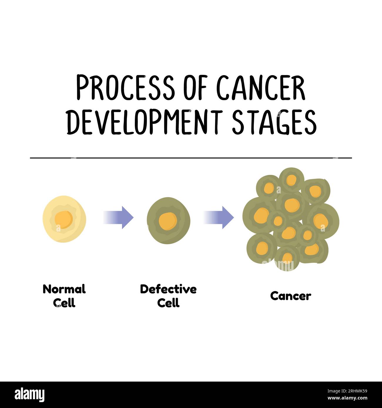 process of cancer development stages illustration isolated on white ...