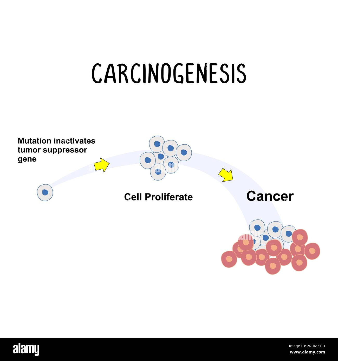 Carcinogenesis