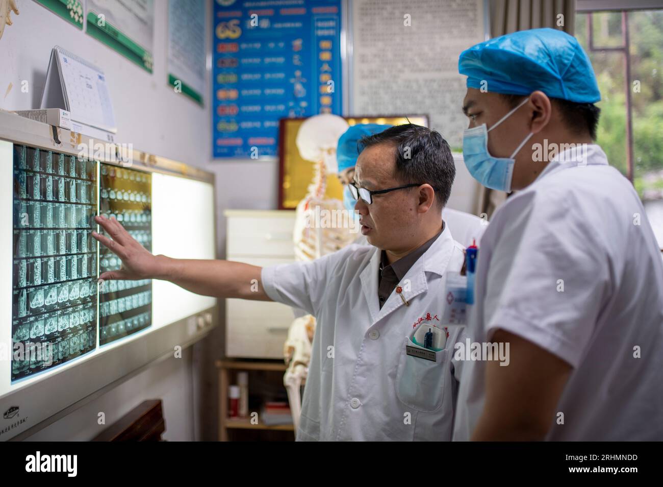 Doctors consult on X-rays in Qiandongnan, Guizhou province, China ...