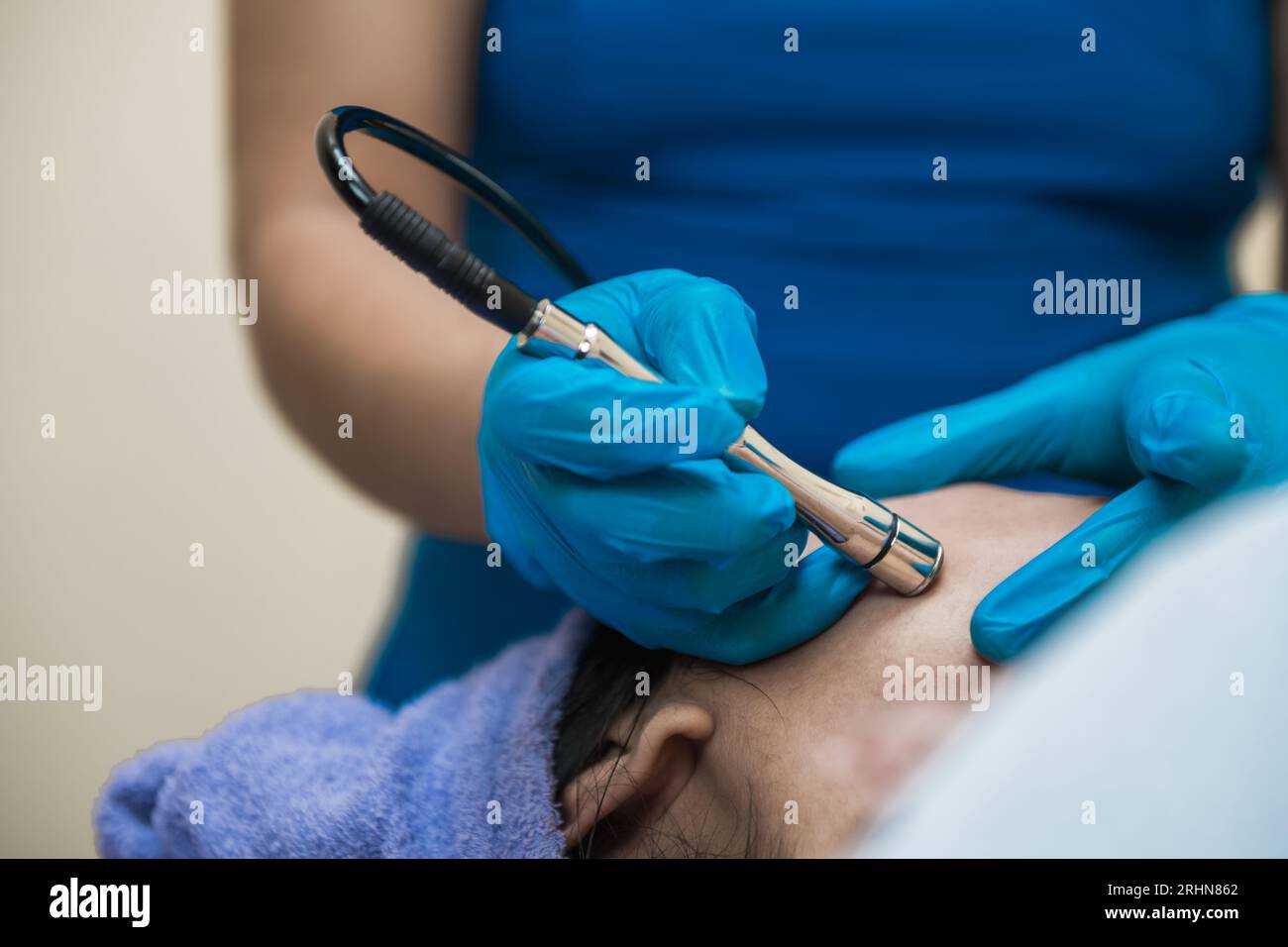 Facial treatment to a woman with dermapen and dermaplaning techniques ...