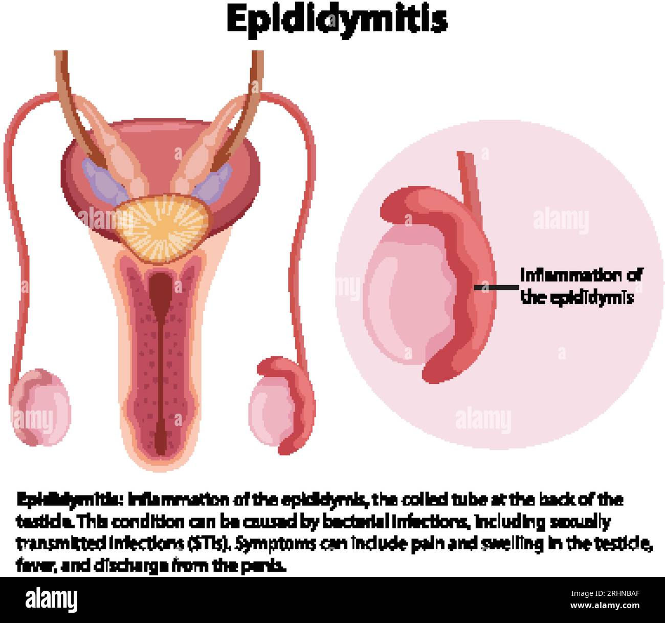 Cartoon Style Infographic Depicting Male Epididymis And Testis Anatomy