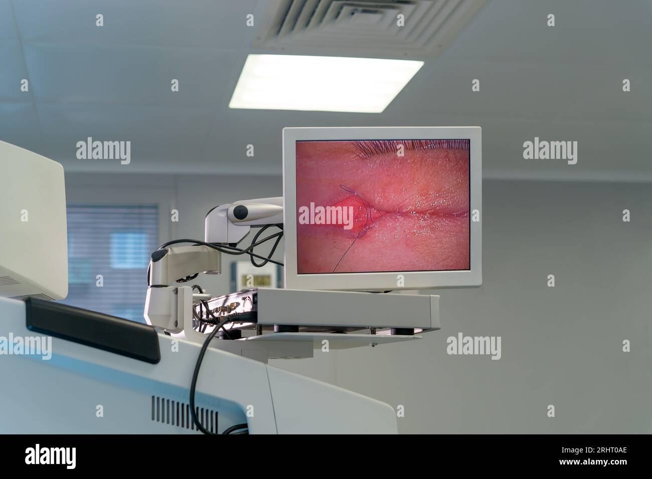 Surgical microscope in the operating room Stock Photo - Alamy