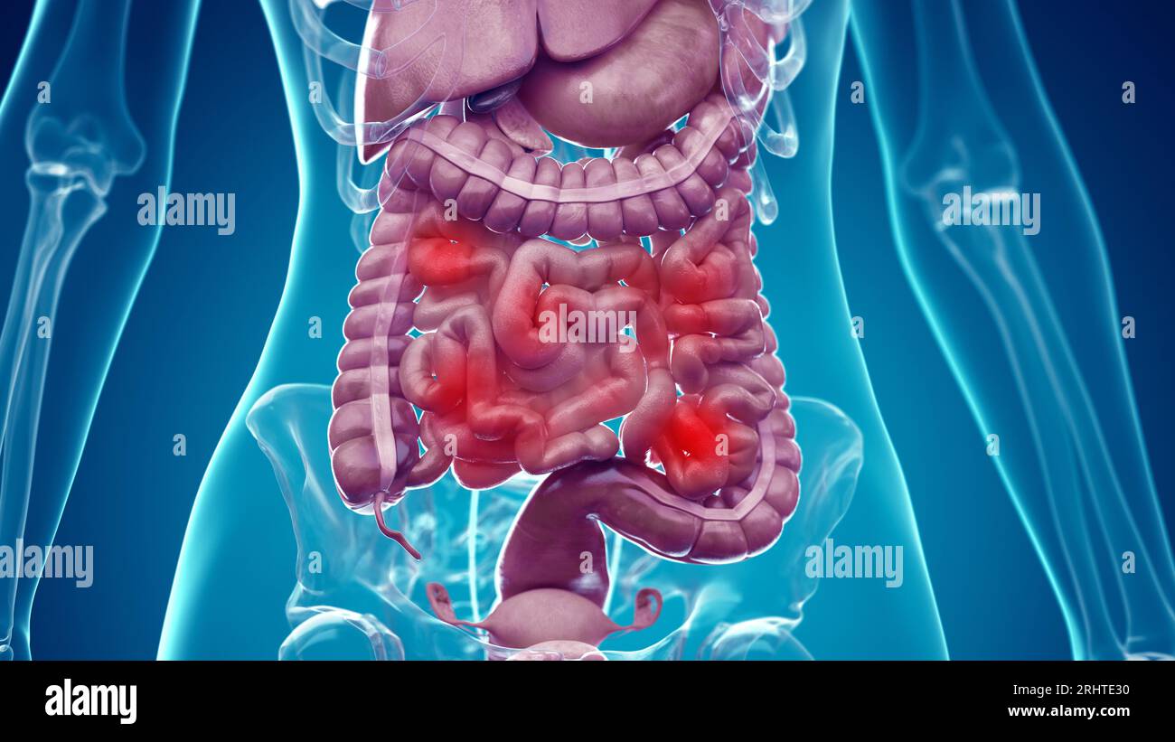 Abdominal organs, illustration Stock Photo - Alamy