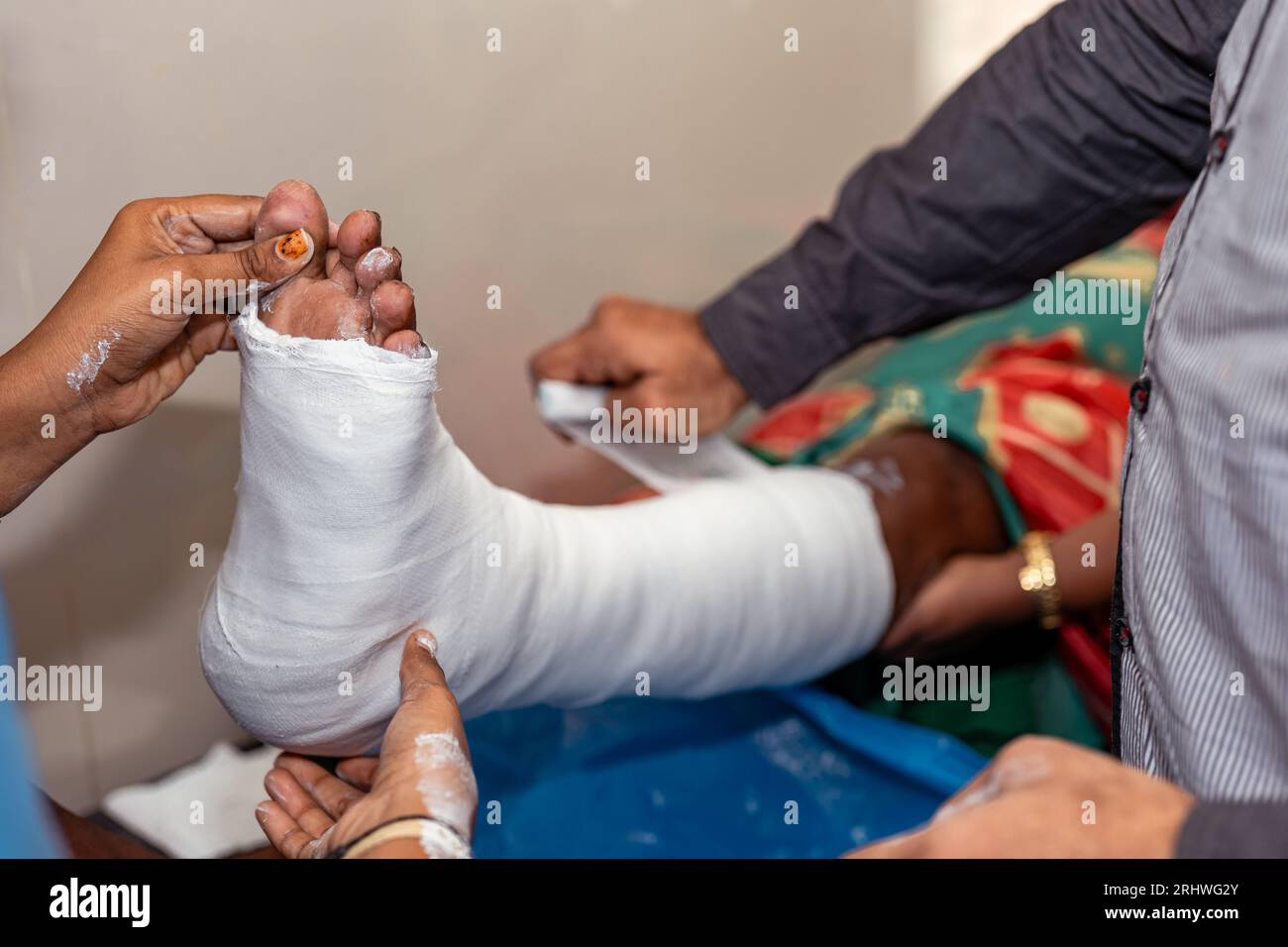 Woman leg cast hi-res stock photography and images - Alamy