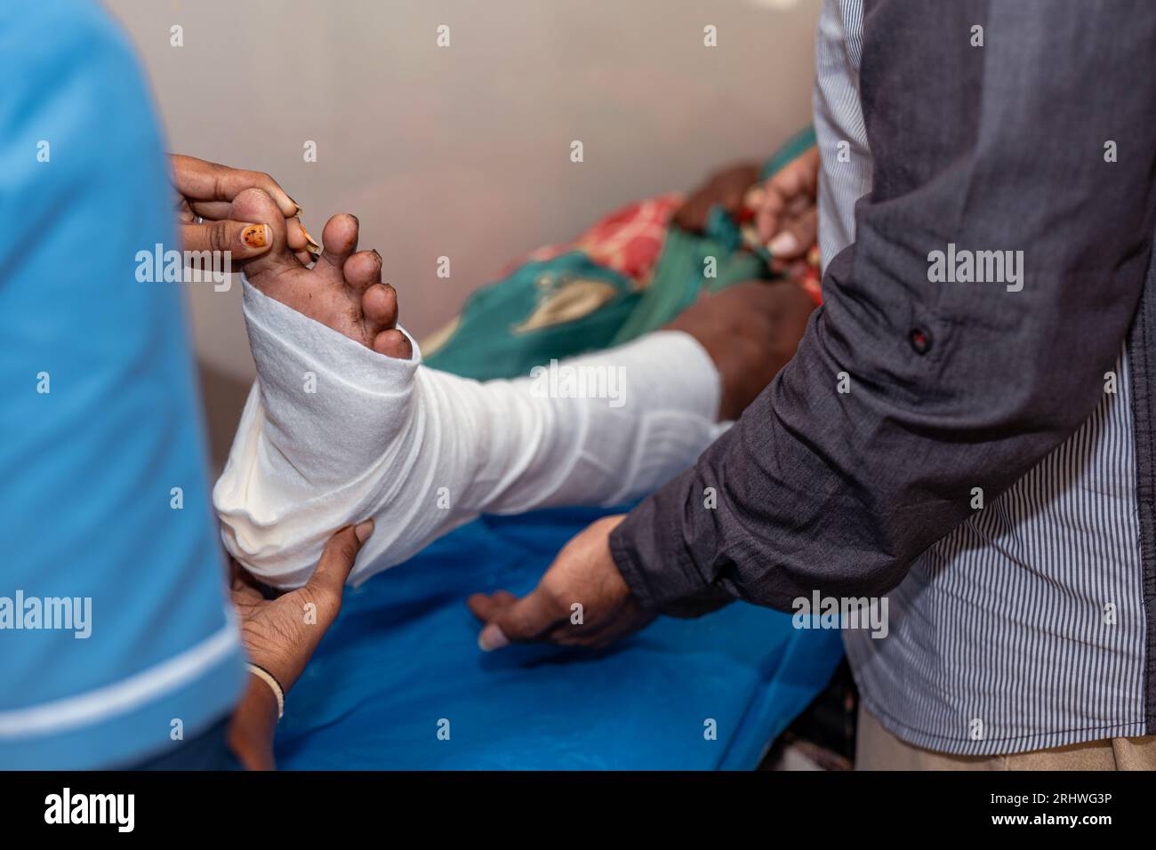 A doctor and nurse are applying a plaster cast to the leg of an elderly ...