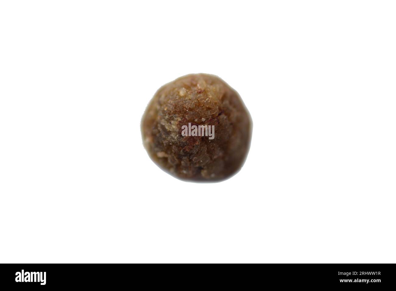 Large gallstone removed surgically after laparoscopic cholecystectomy ...