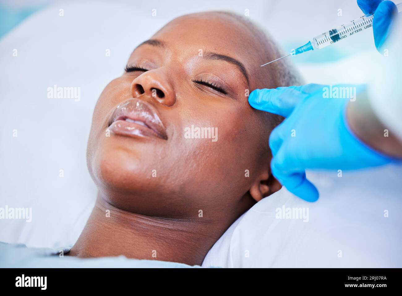 Plastic surgery, injection and black woman on a hospital bed with ...