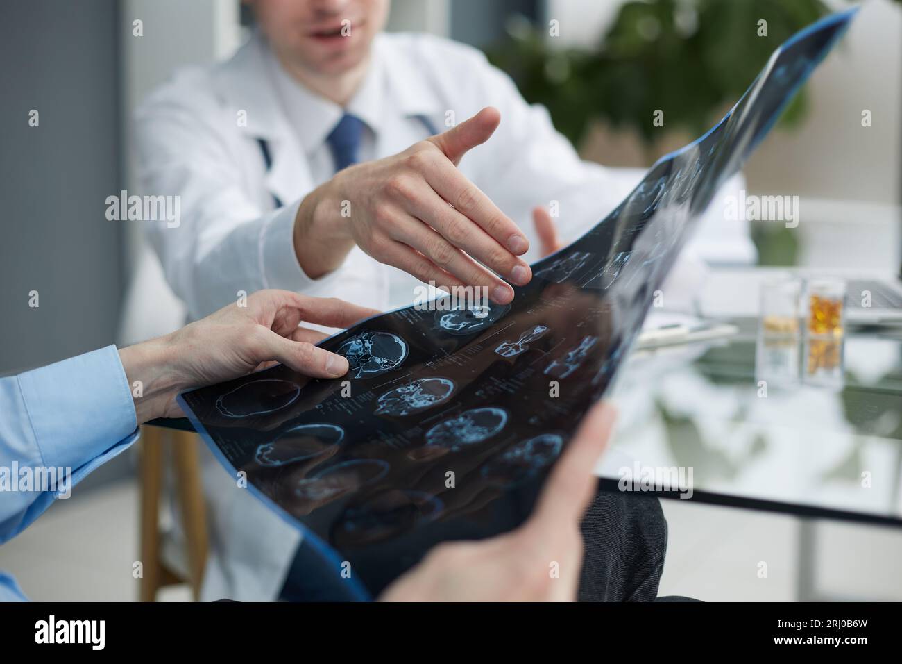 shows the x-ray image to the patient at the reception Stock Photo - Alamy