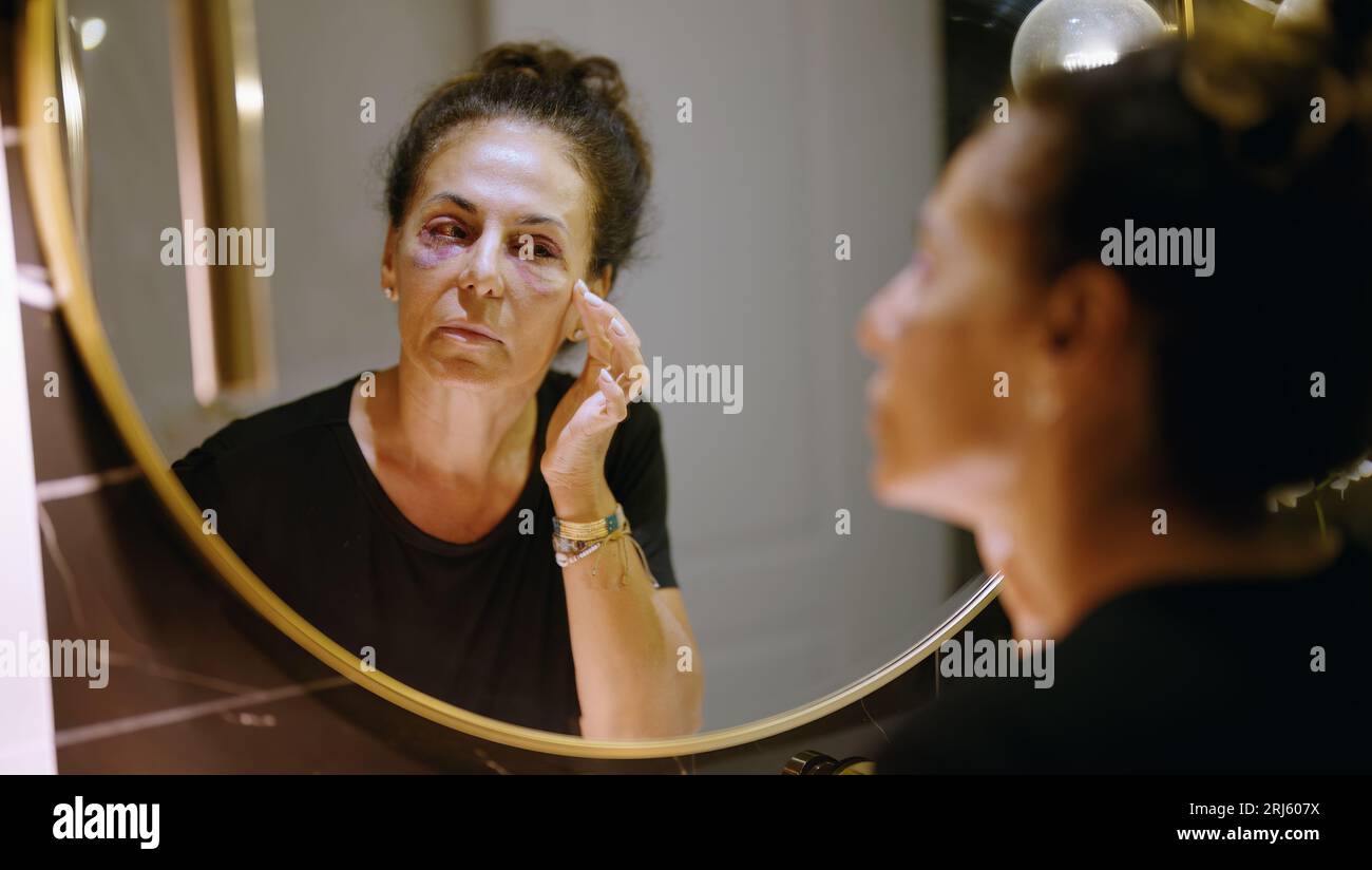 Middle age hispanic woman suffering for domestic violence looking on ...