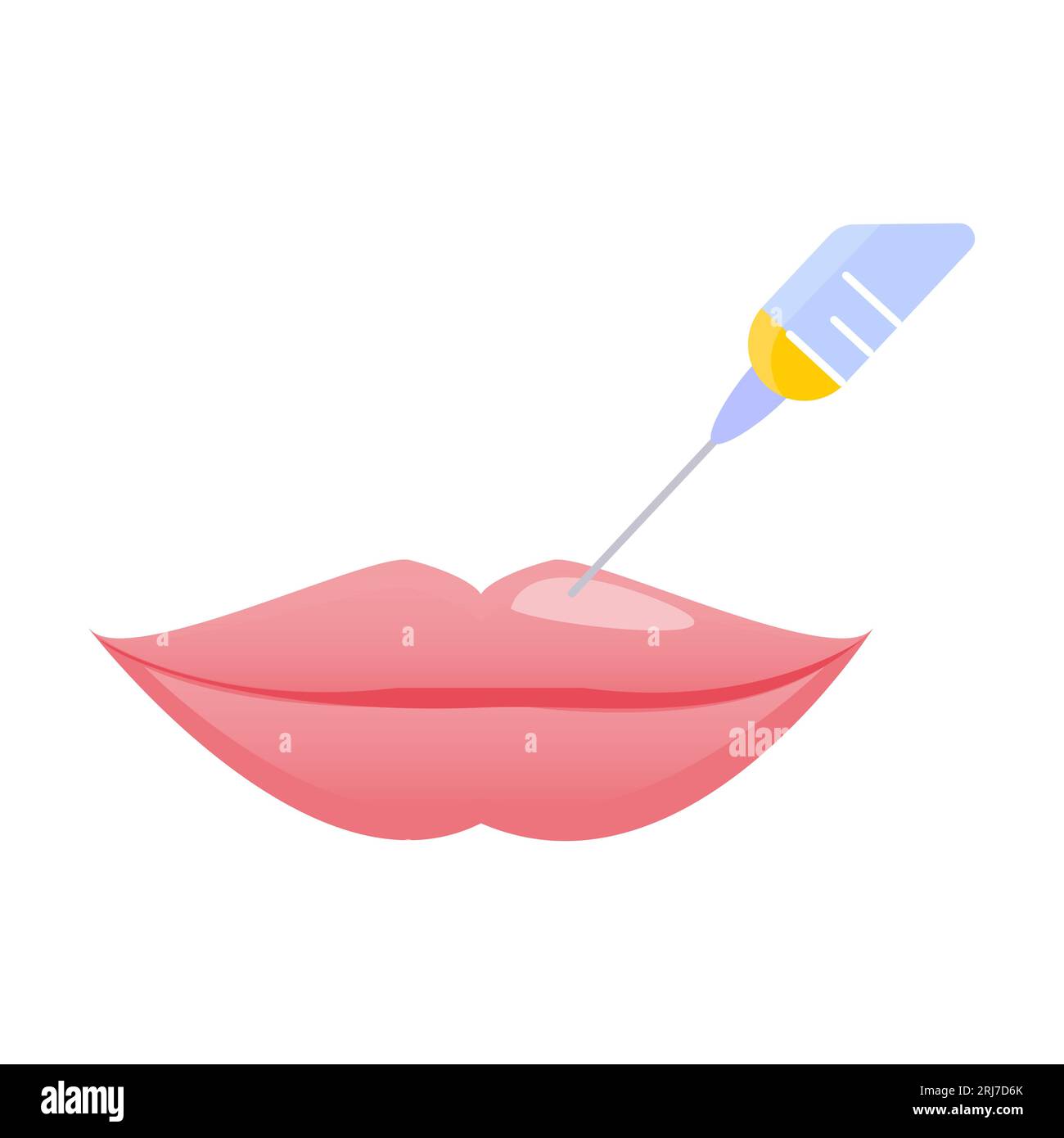 Lip plumping augmentation with filler injection illustration Stock ... Lip plumping augmentation with filler injection illustration Stock ...