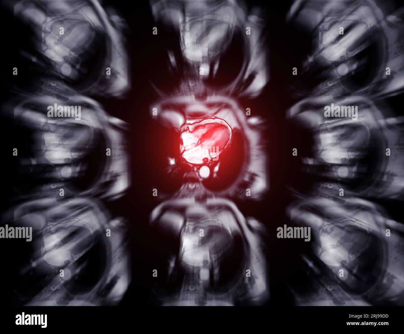 MRI heart or Cardiac MRI ( magnetic resonance imaging ) of heart for ...
