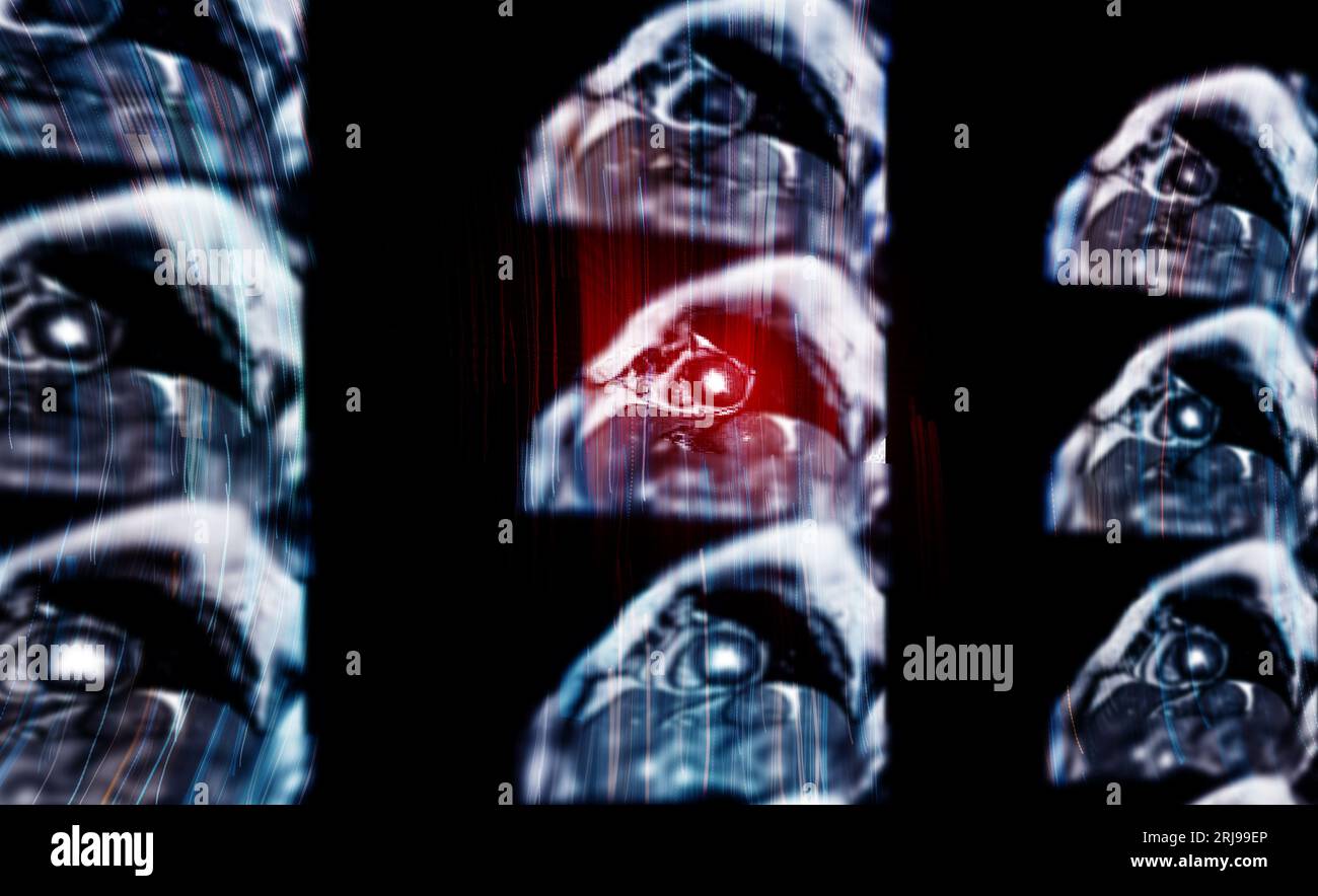 MRI heart or Cardiac MRI ( magnetic resonance imaging ) of heart for ...