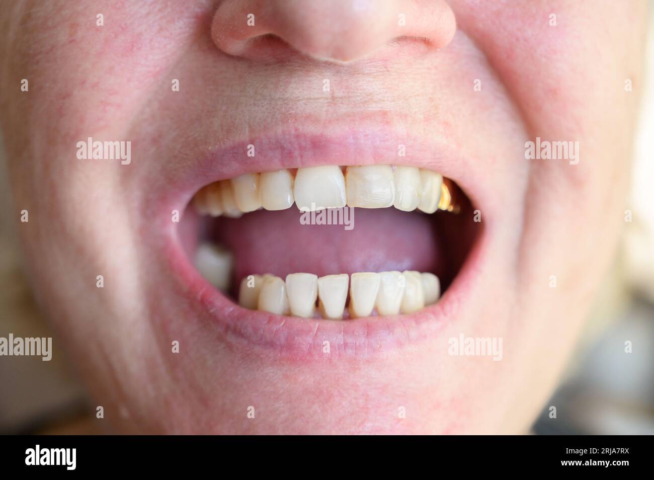 Close-up photo of natural looking teeth of a aged woman Stock Photo - Alamy