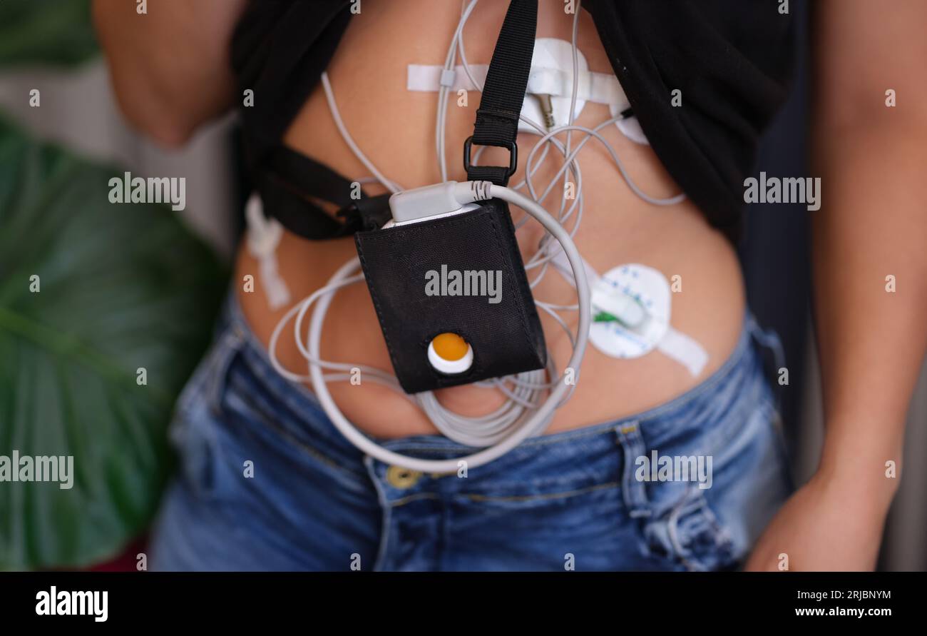 Woman with Holter monitor for daily monitoring of electrocardiogram and ...