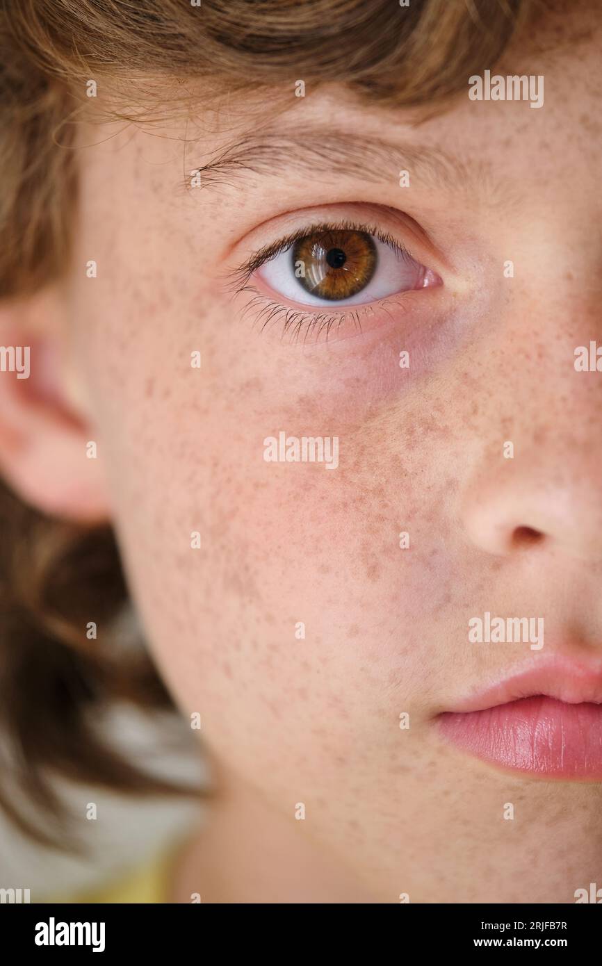 Closeup of crop kid with freckles on face skin and brown hair looking ...