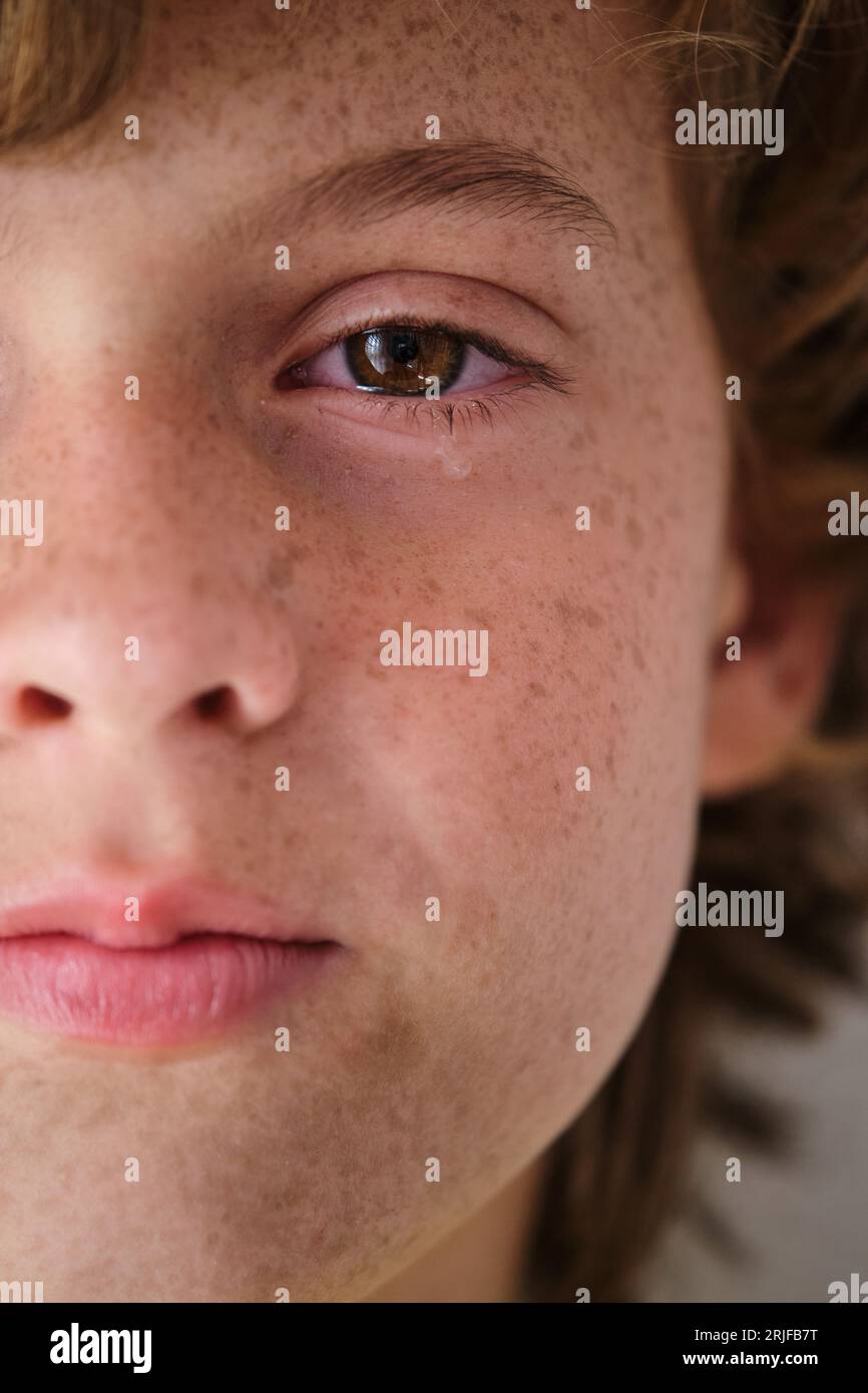 Closeup of crop unhappy child with brown eye and freckles looking at ...