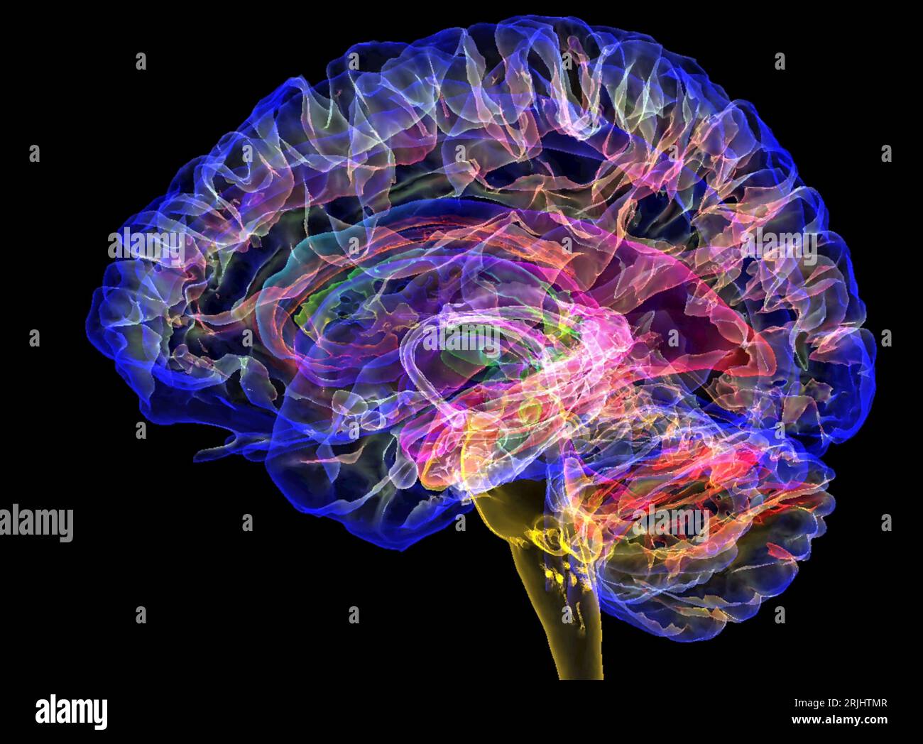 Human brain, 3D MRI scan Stock Photo - Alamy